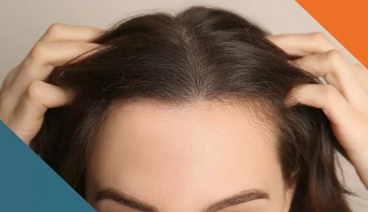 Exploring the Diversity of Female Hairlines - Optima Hair